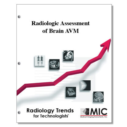 Radiologic Assessment of Brain AVM - Medical Imaging Consultants, Inc.