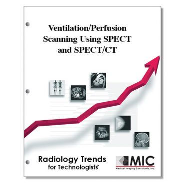 Ventilation/Perfusion Scanning Using SPECT and SPECT/CT - Medical Imaging Consultants, Inc.