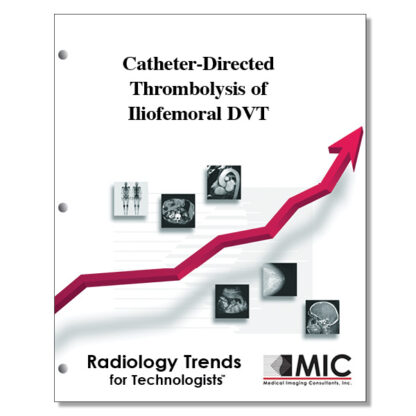 Catheter-Directed Thrombolysis of Iliofemoral DVT - Medical Imaging ...