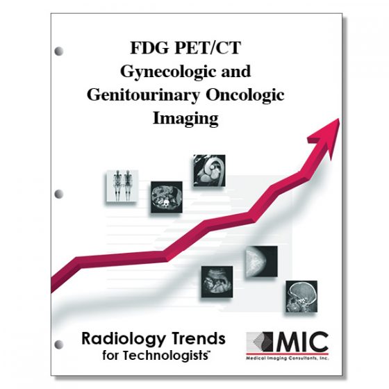 FDG PET/CT Gynecologic and Genitourinary Oncologic Imaging - Medical ...